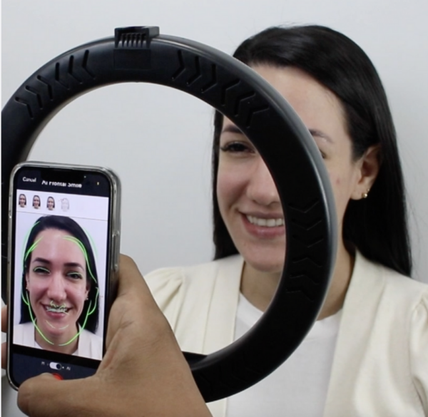 3D A.I. Smile Simulation: How to Perform Smile Harmony in Asymmetrical ...